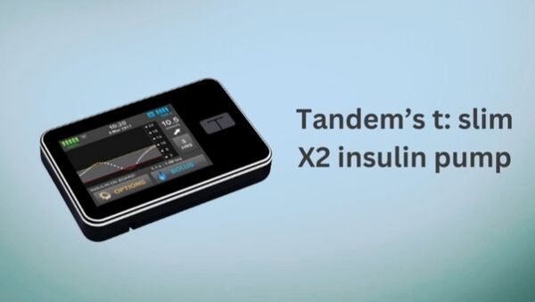 5 Best Continuous Glucose Monitors [ Updated List ] - 2025