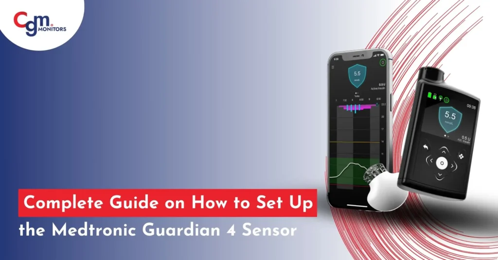How to Set Up Medtronic Guardian Sensor